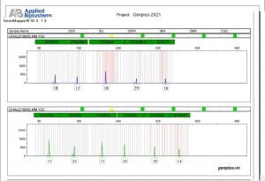 Báo Giá Xét Nghiệm ADN Ông Và Cháu, Trả Kết Quả Sau 4 Giờ