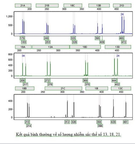 Xét nghiệm QF-PCR Chẩn Đoán Trước Sinh, Chi Phí Và Quy Trình