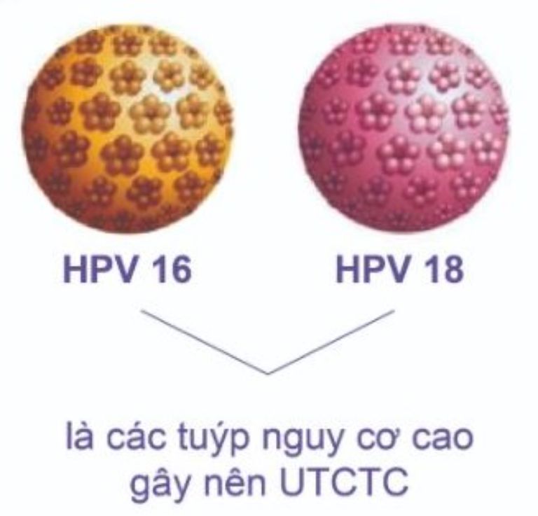 Virus HPV 16 HPV 18 Gây Bệnh Ung Thư Cổ Tử Cung Tư Vấn A-Z