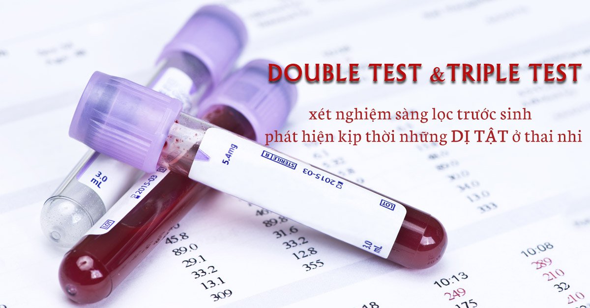 So Sánh Double Test và Triple Test, Nên Làm Xét Nghiệm Nào?
